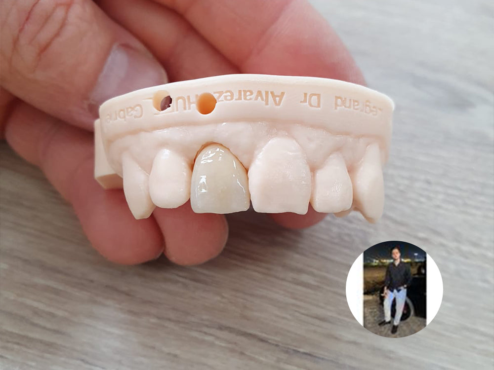 2024-09-24 case: From:French Author:Legrand Material:press ingots LTA3 – Beautyzir dental