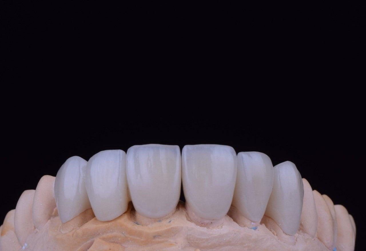 Zirconia dental implants：the relationship between design and clinical ...